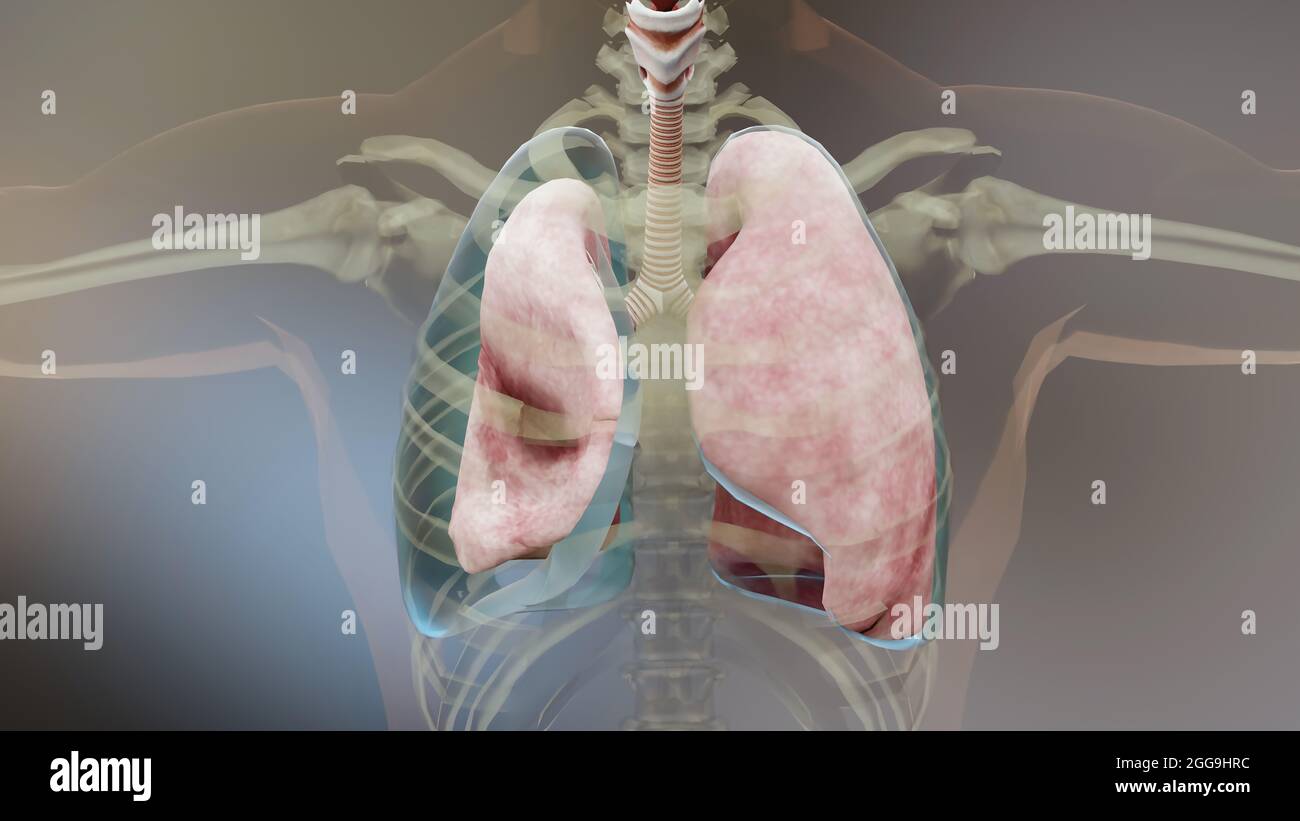 3d Illustration of Pneumothorax, Normal lung versus collapsed, symptoms ...