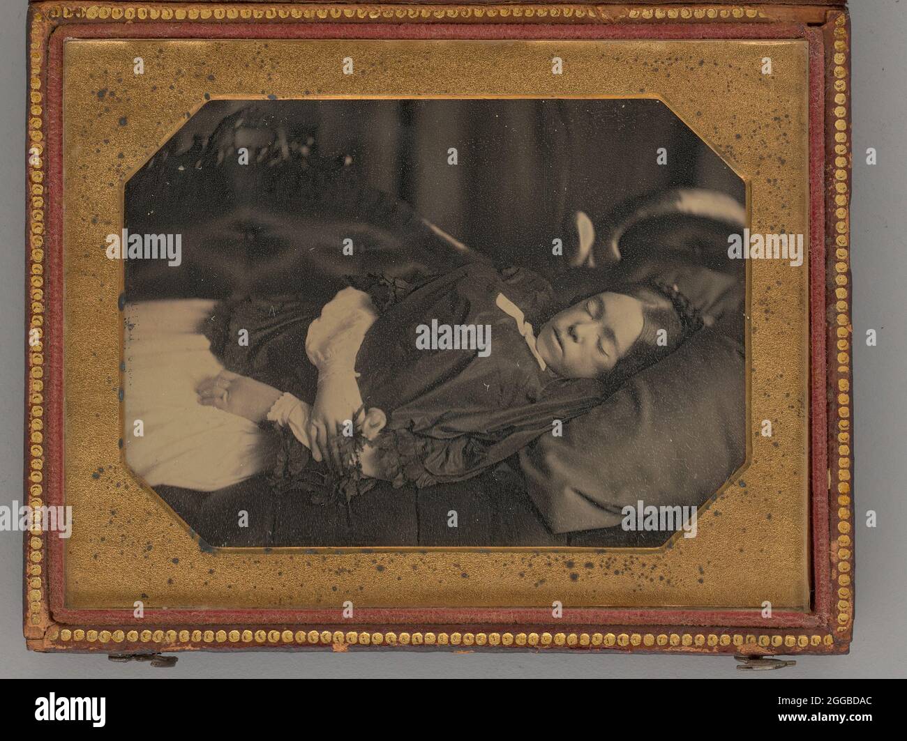 Real Postmortem Of Girl