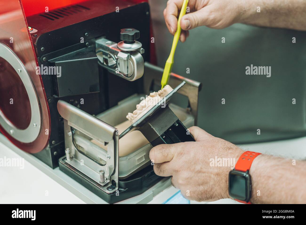 Man's hand collecting the excess of resin from a 3D dental printer in a ...