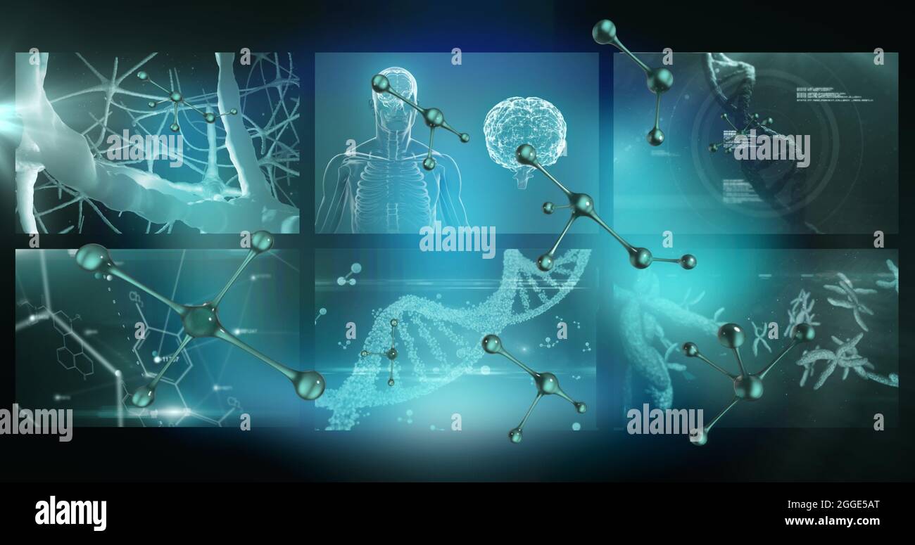 Image of medical data processing on screens Stock Photo - Alamy