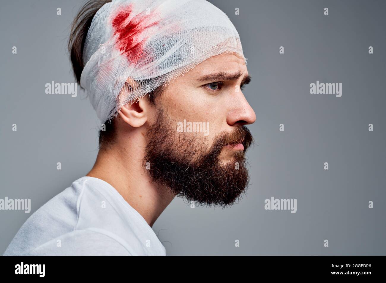 patient head and arm injuries health problems isolated background Stock ...