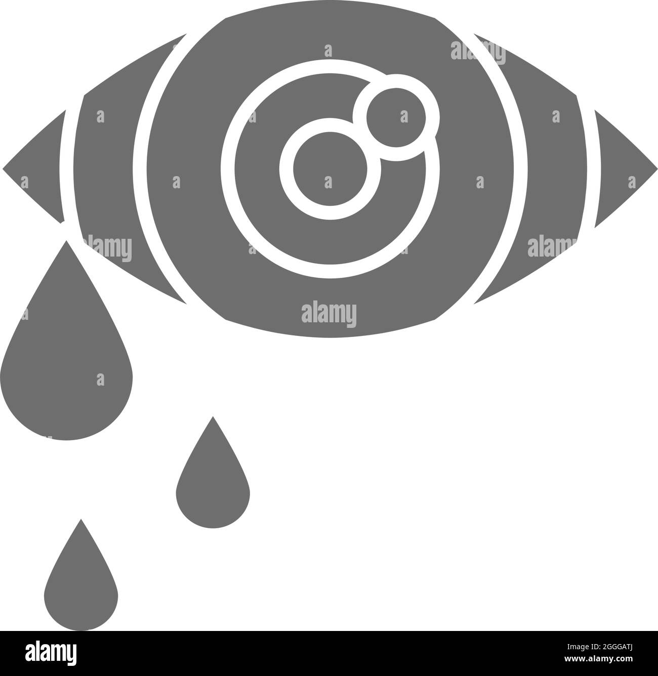 An allergic reaction in the human eye hi-res stock photography and ...