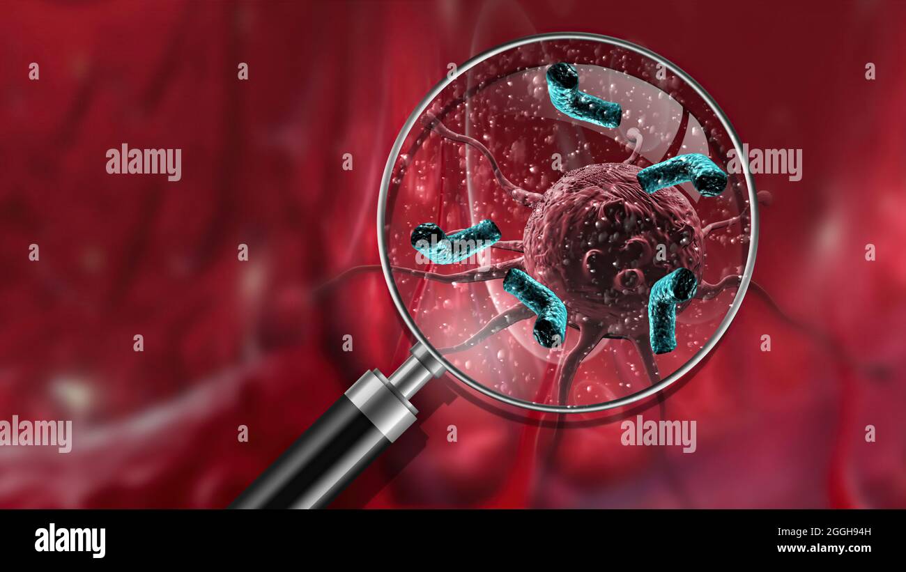 3d illustration - A Damaged And Disintegrating Cancer Cell Stock Photo ...