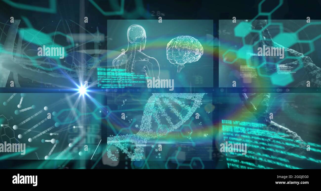 Image of dna strand and medical data processing on screens Stock Photo ...