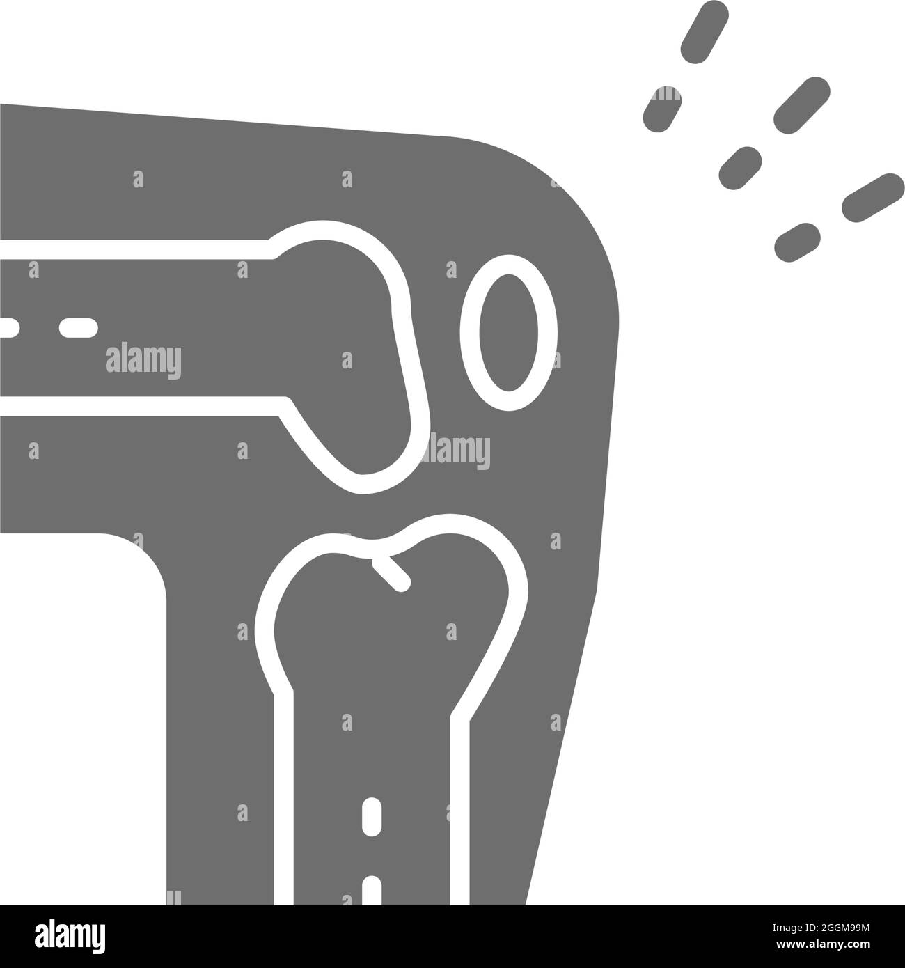 Healthy knee ray Stock Vector Images - Alamy