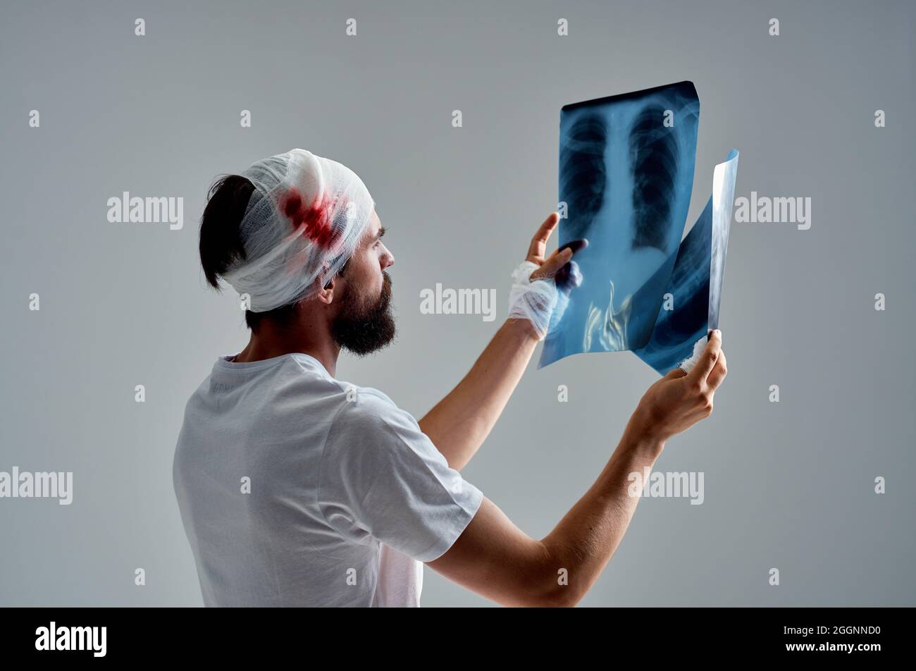 a patient head injury radiology treatment health care Stock Photo - Alamy