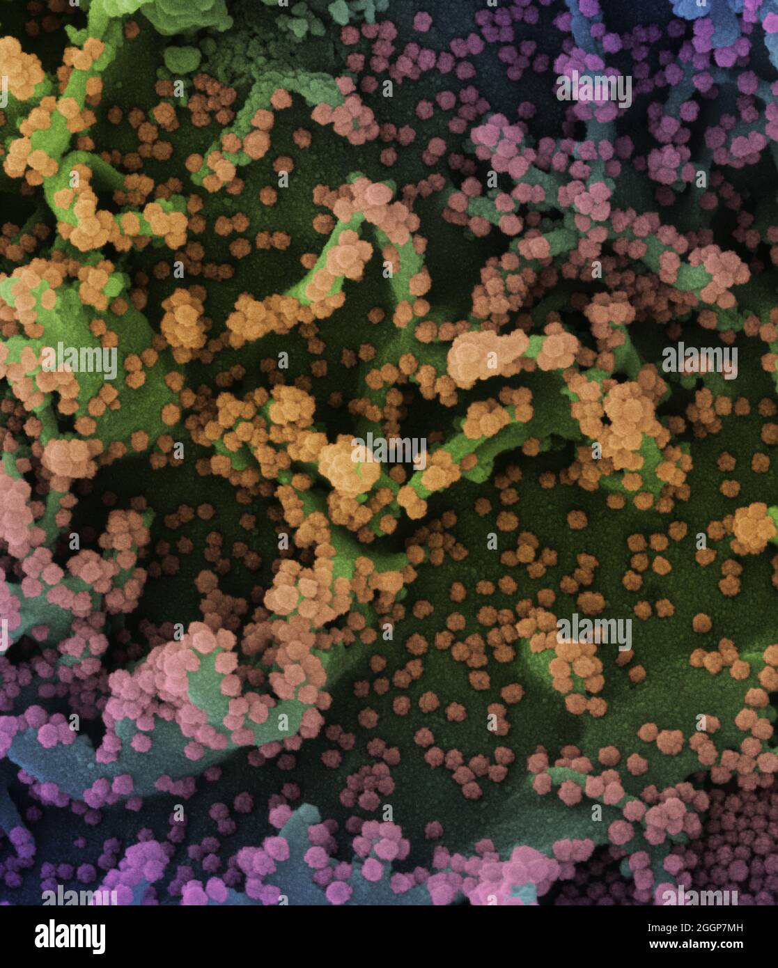 Colorized scanning electron micrograph of a cell (green) heavily ...