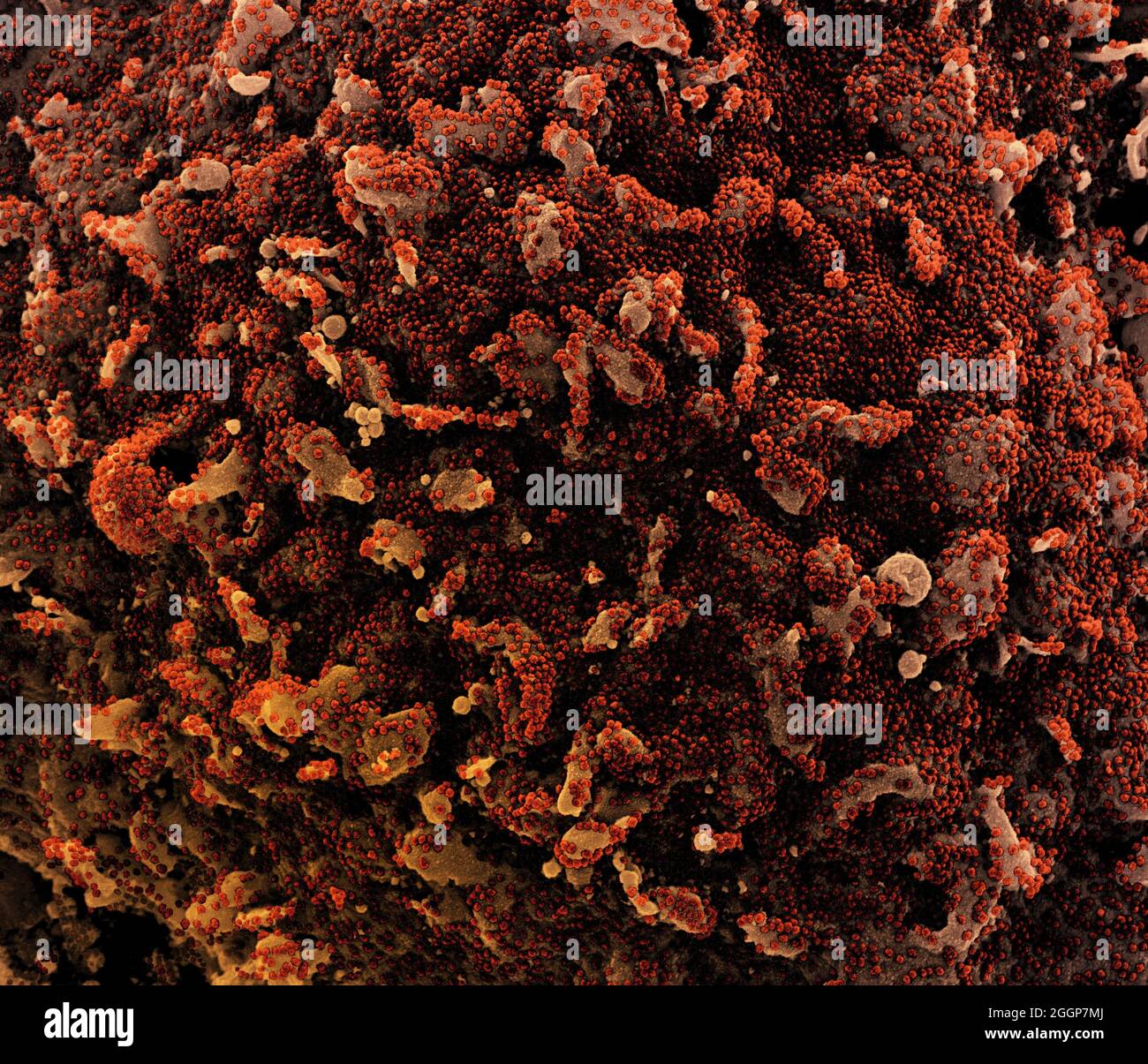 Colorized scanning electron micrograph of a cell (brown) heavily ...