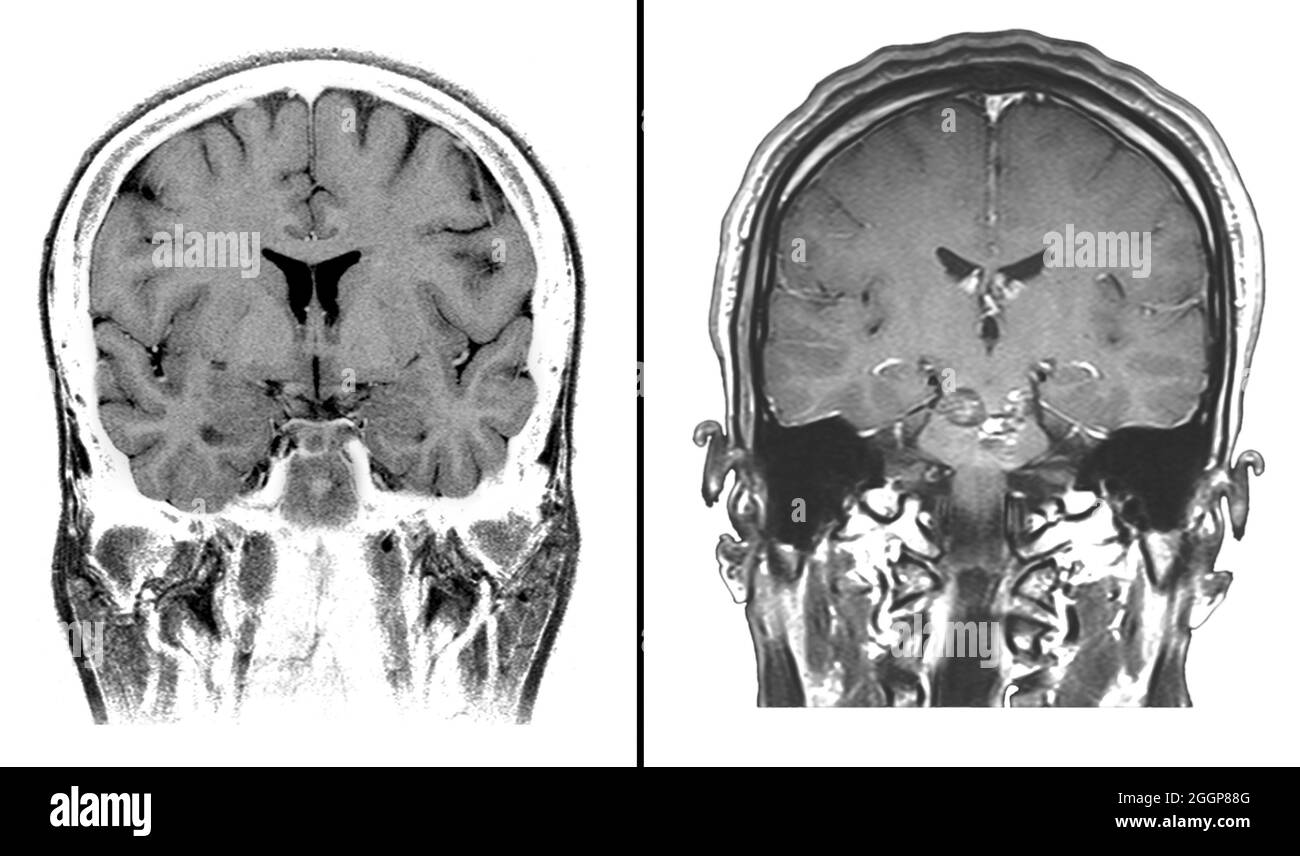 Cross Sectional View Black and White Stock Photos & Images - Alamy