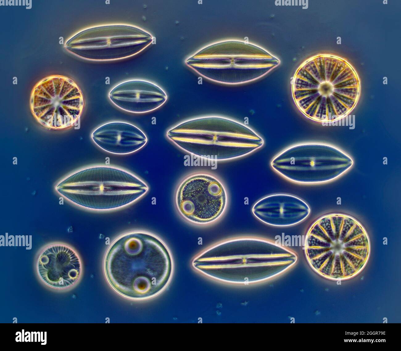 Negative phase contrast hi-res stock photography and images - Alamy