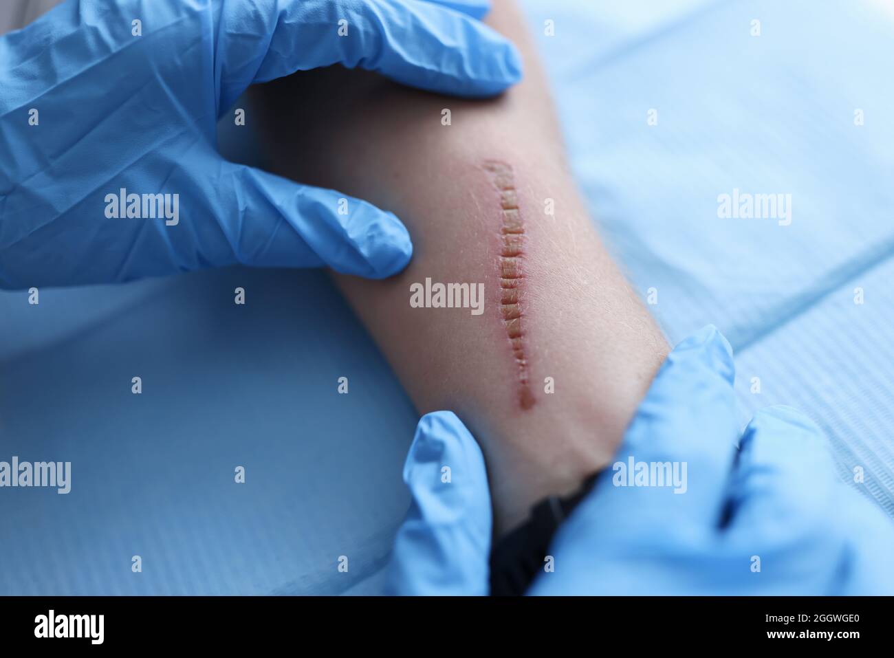 Diagnosis rabies hi-res stock photography and images - Alamy