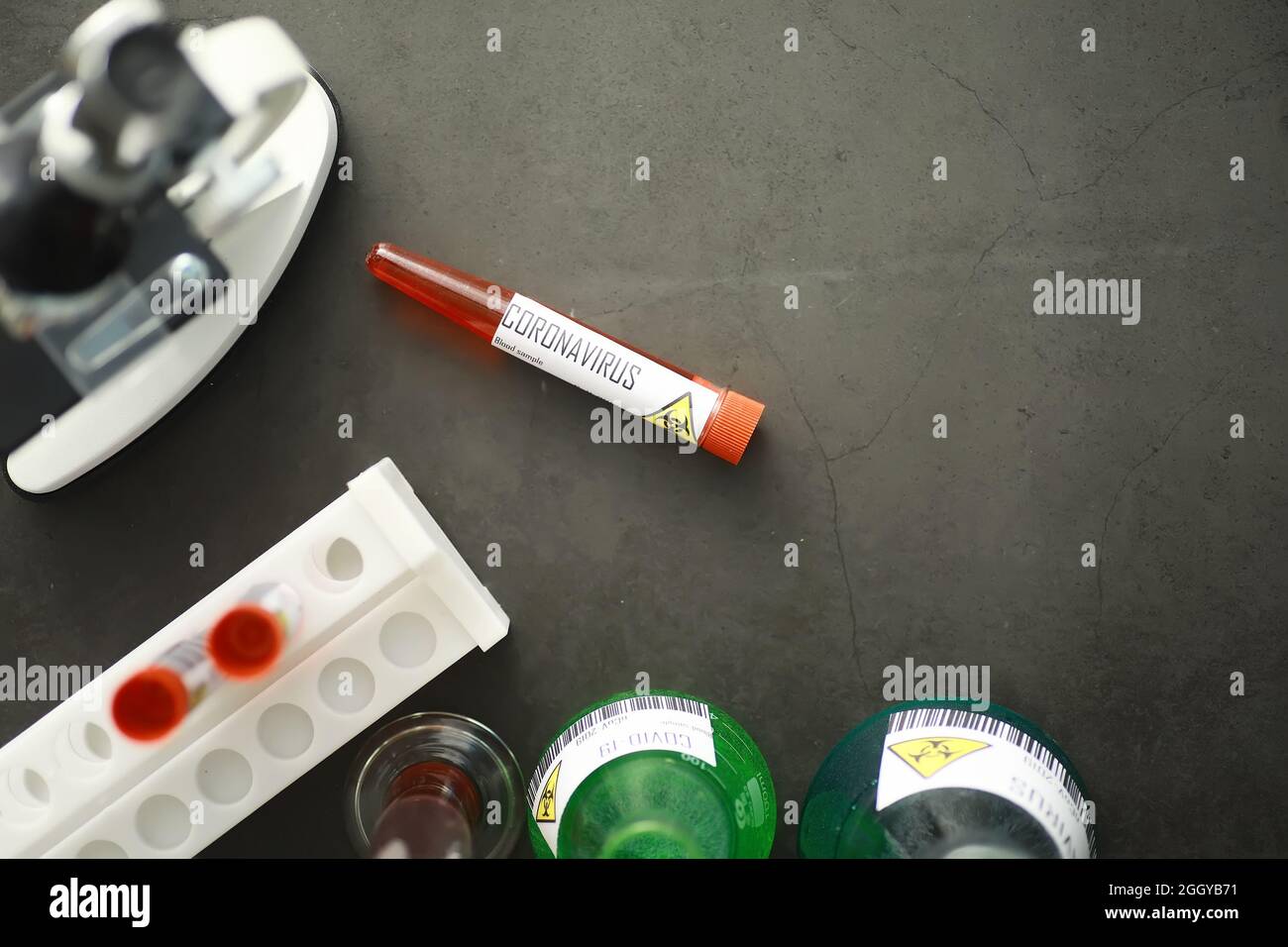 A blood sample for testing the dangerous virus coronavirus in body ...