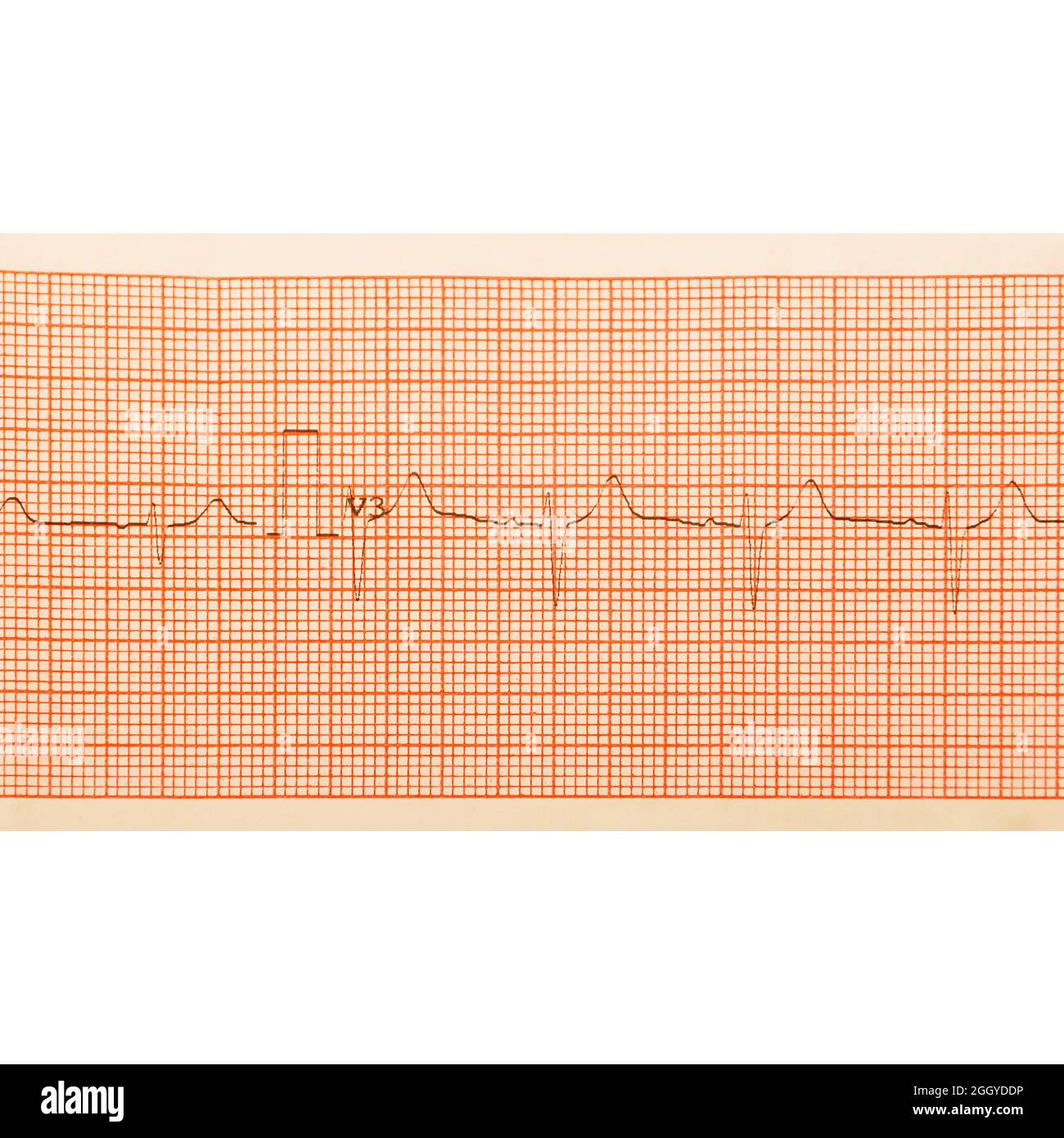 Ecg test hi-res stock photography and images - Alamy