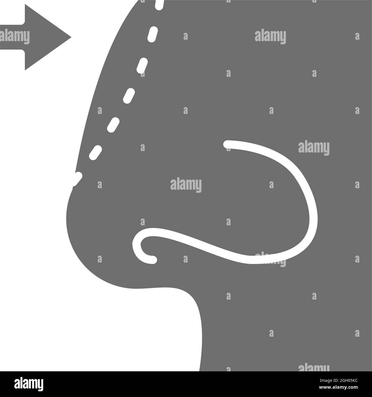 Rhinoplasty, nose plastic surgery grey icon. Isolated on white ...