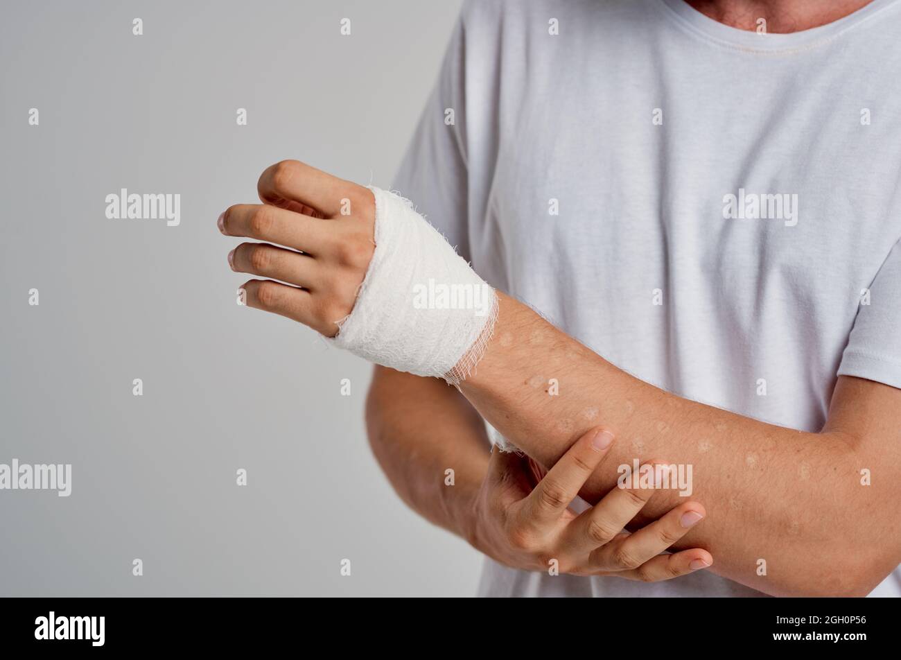 bandaged arm health problems pain injury Stock Photo - Alamy