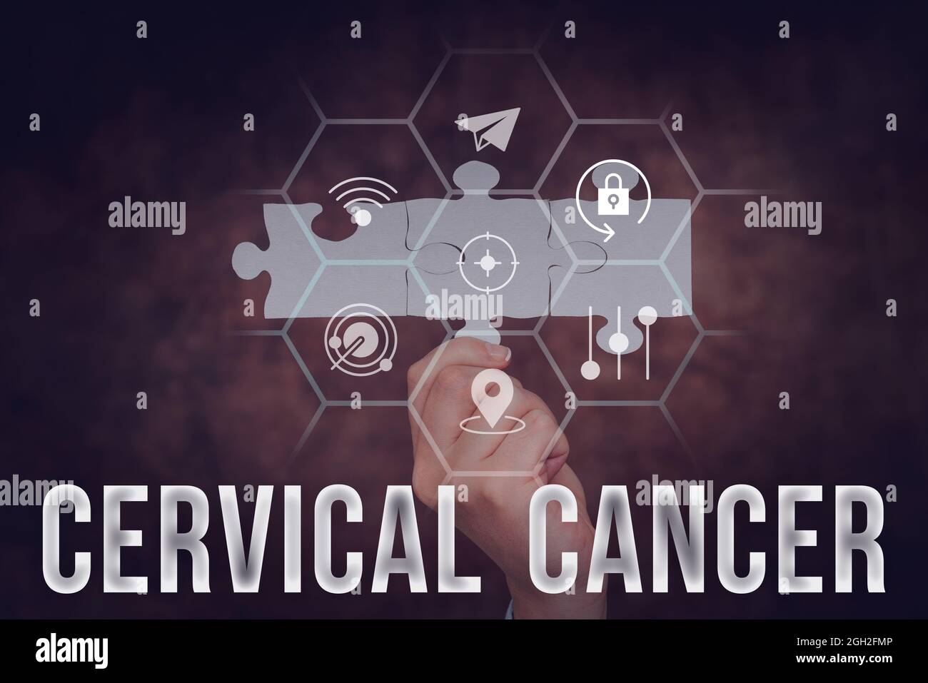 Conceptual display Cervical Cancer. Internet Concept type of cancer ...