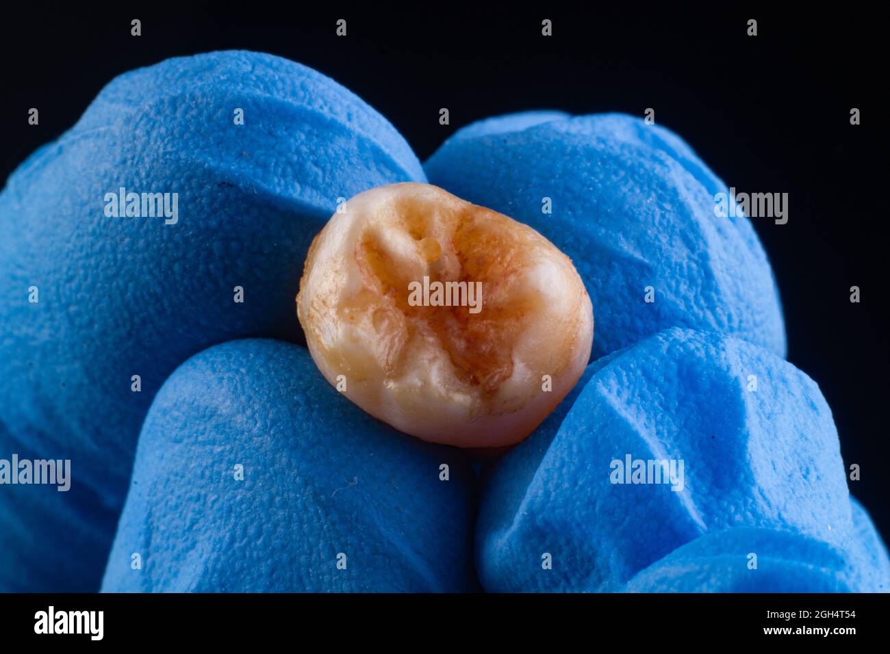 Oral destruction hi-res stock photography and images - Alamy