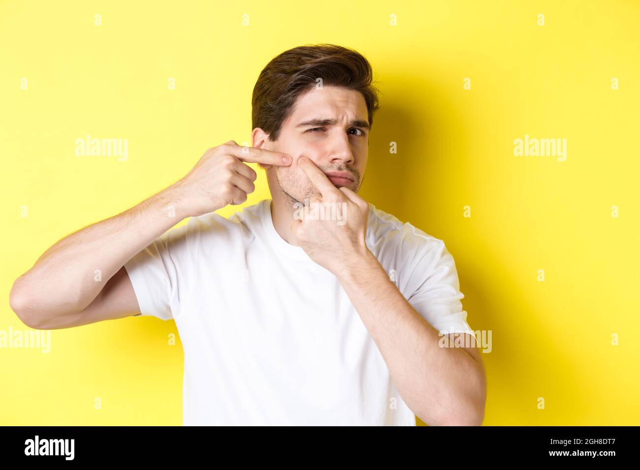 Young man pop a pimple on cheek, standing over yellow background ...