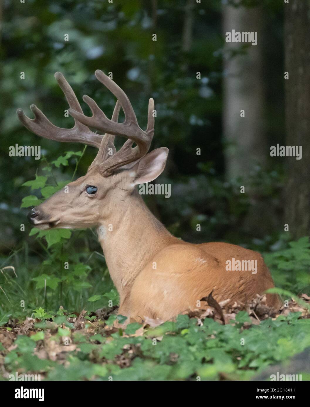 Corneal Opacities Affecting Vision