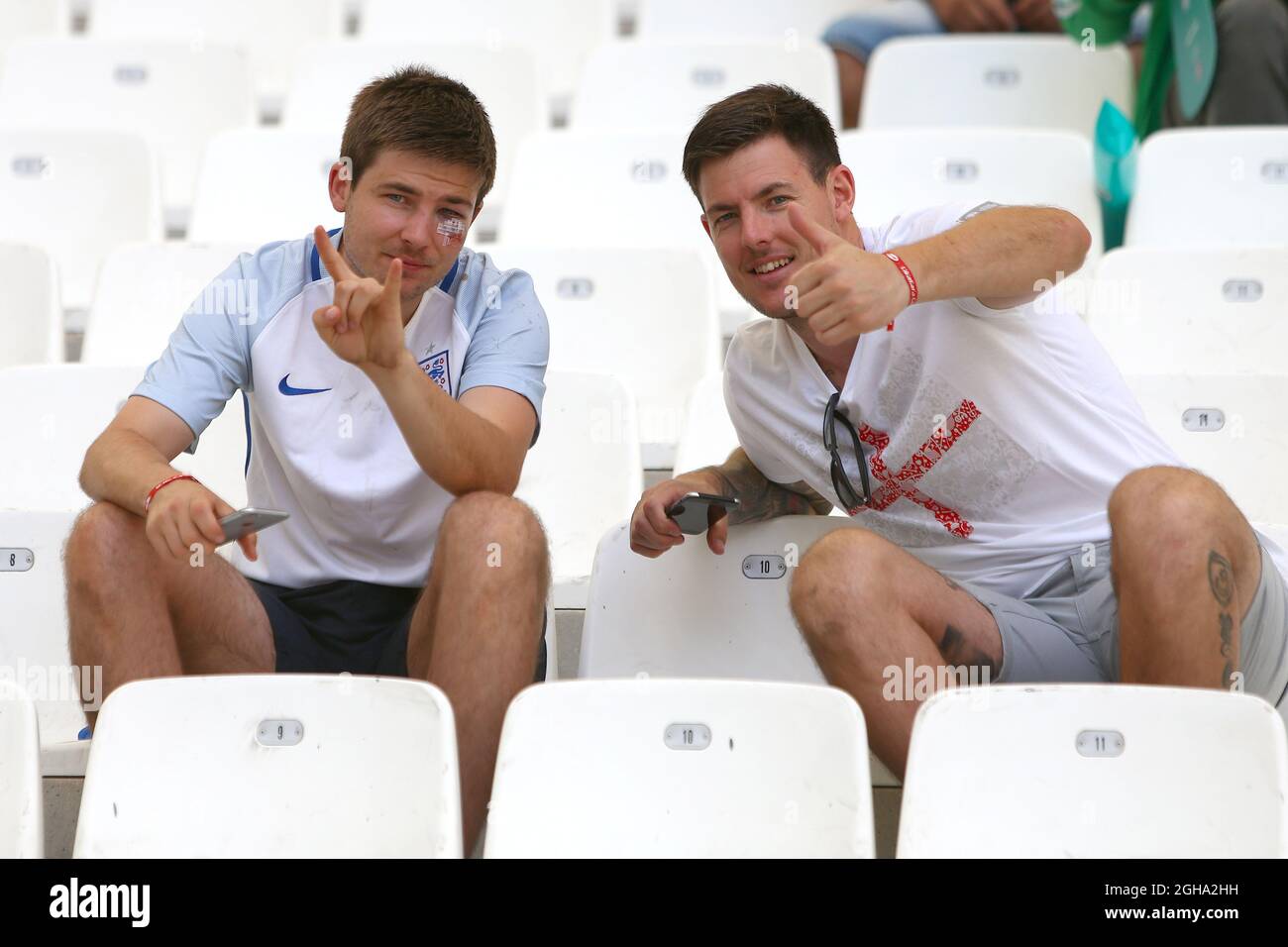 An England fan with stitches to his face gives the thumbs up ahead of ...