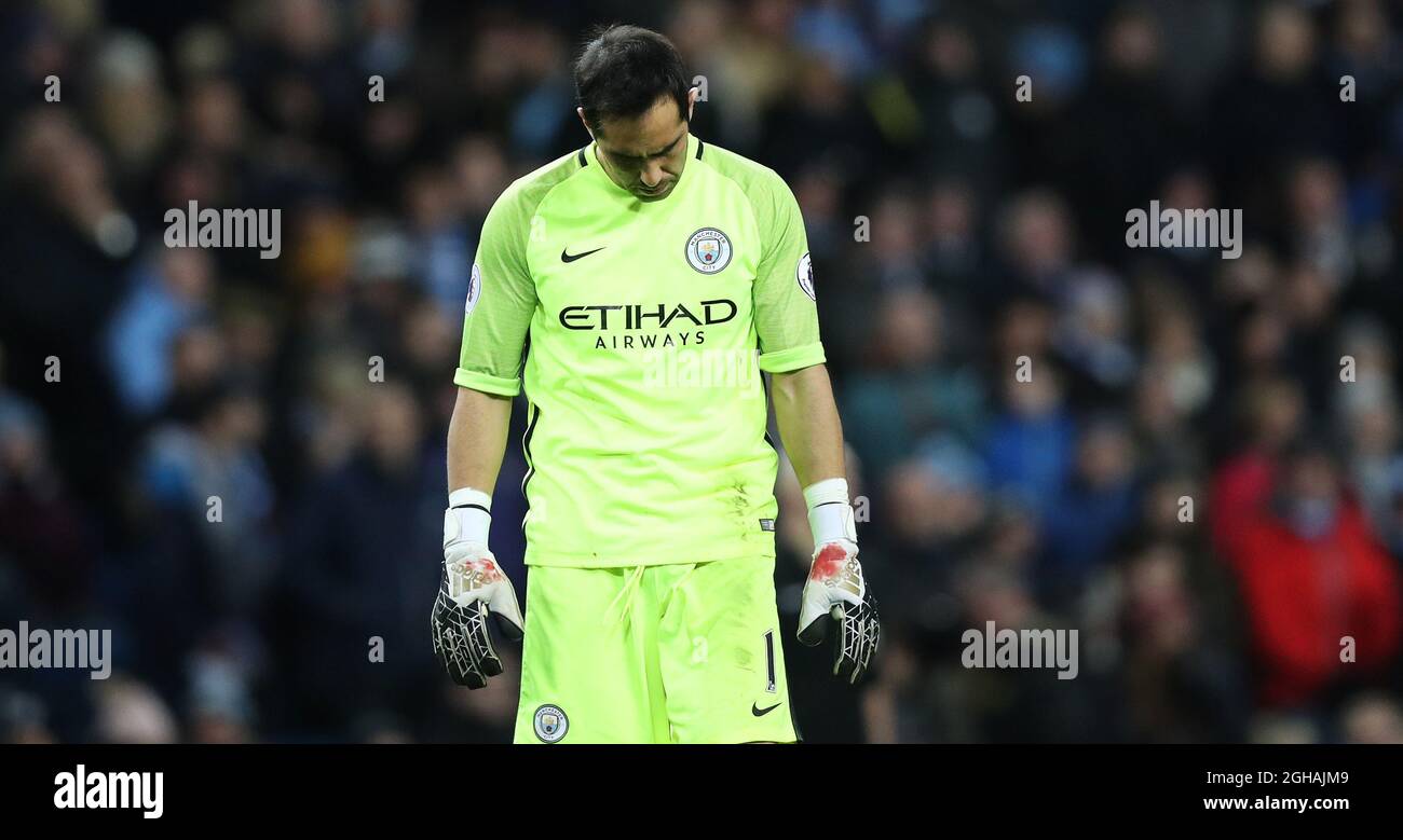 Claudio Bravo of Manchester City bleeding after Burnley score during ...