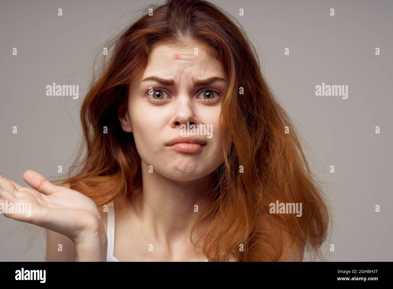 pretty woman facial skin problems dermatology light background Stock ...