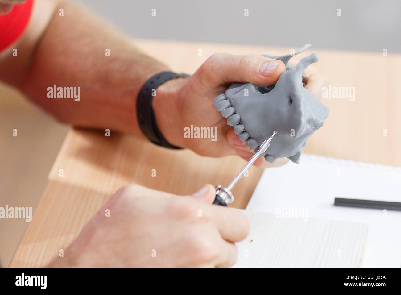 Dentist practice with mini screw model on dental model. Orthodontic ...