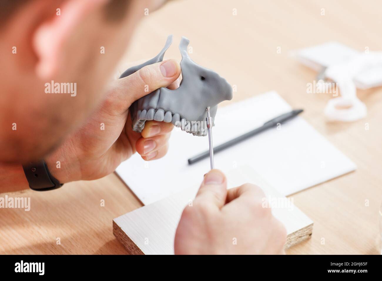 Dentist practice with mini screw model on dental model. Orthodontic ...