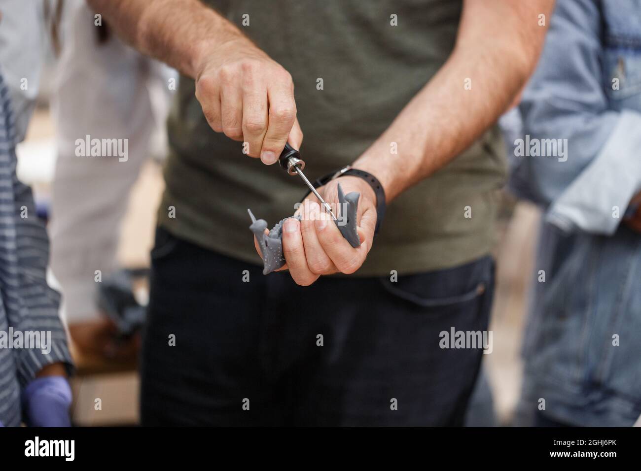 Dentist practice with mini screw model on dental model. Orthodontic ...