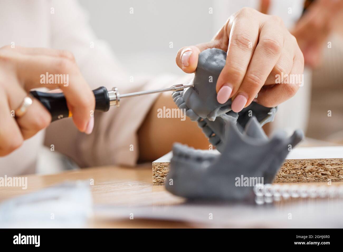 Dentist practice with mini screw model on dental model. Orthodontic ...