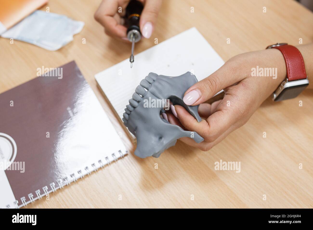 Dentist practice with mini screw model on dental model. Orthodontic ...