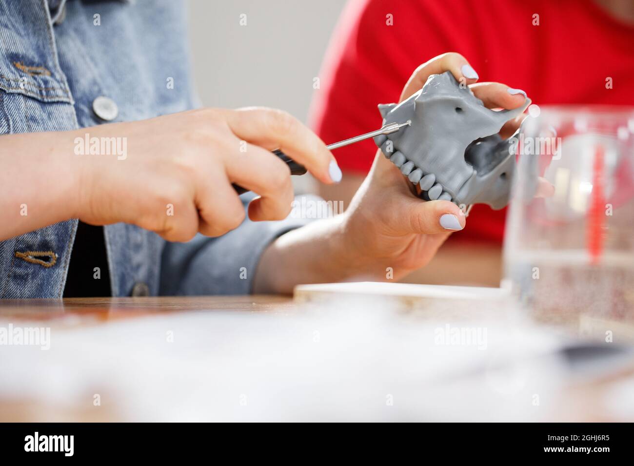 Dentist practice with mini screw model on dental model. Orthodontic ...