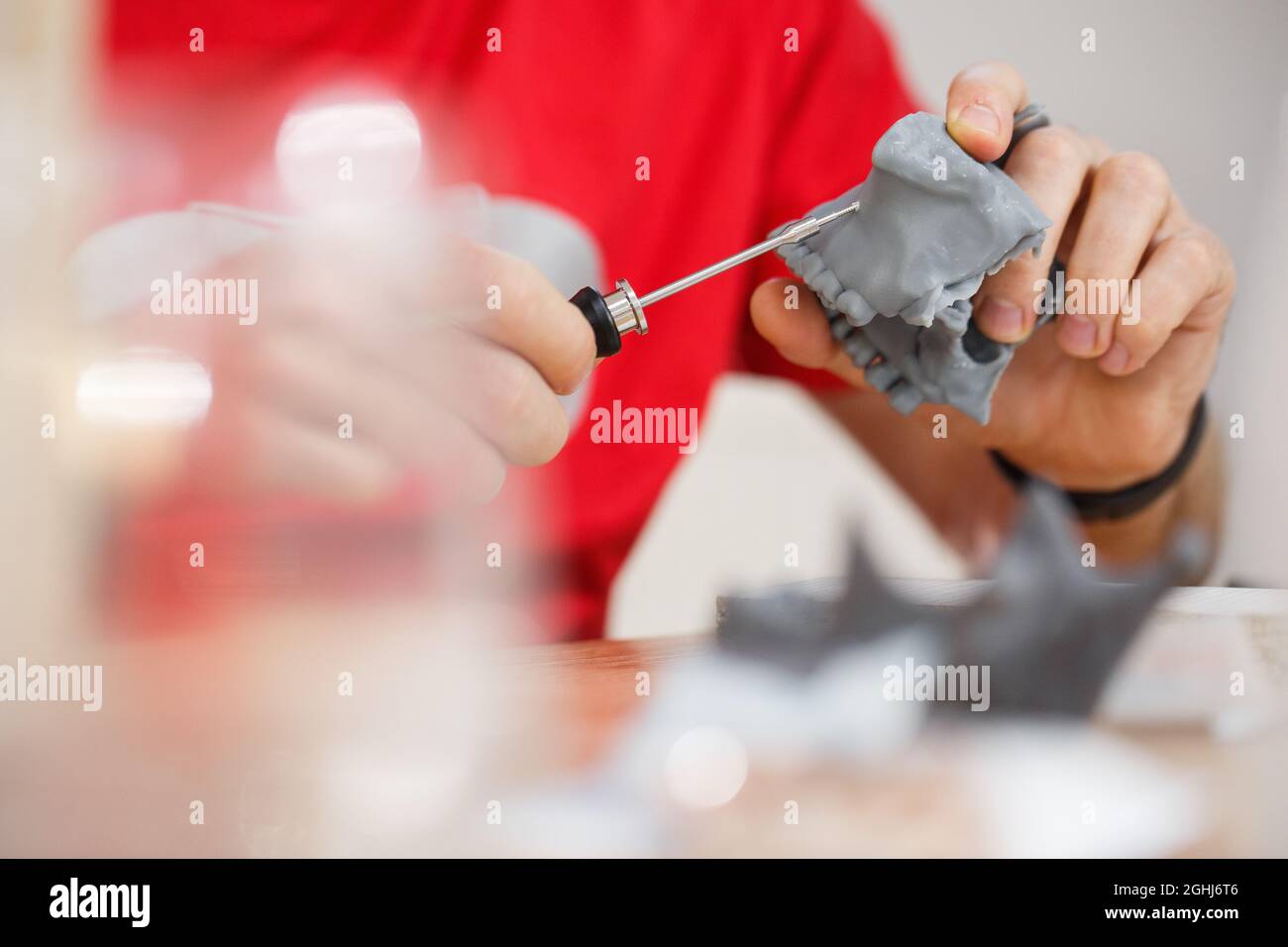 Dentist practice with mini screw model on dental model. Orthodontic ...