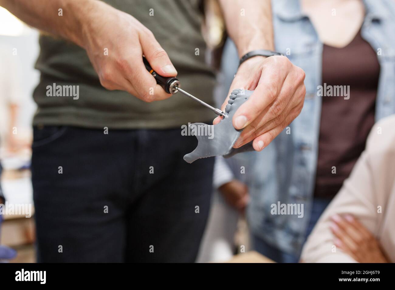 Dentist practice with mini screw model on dental model. Orthodontic ...