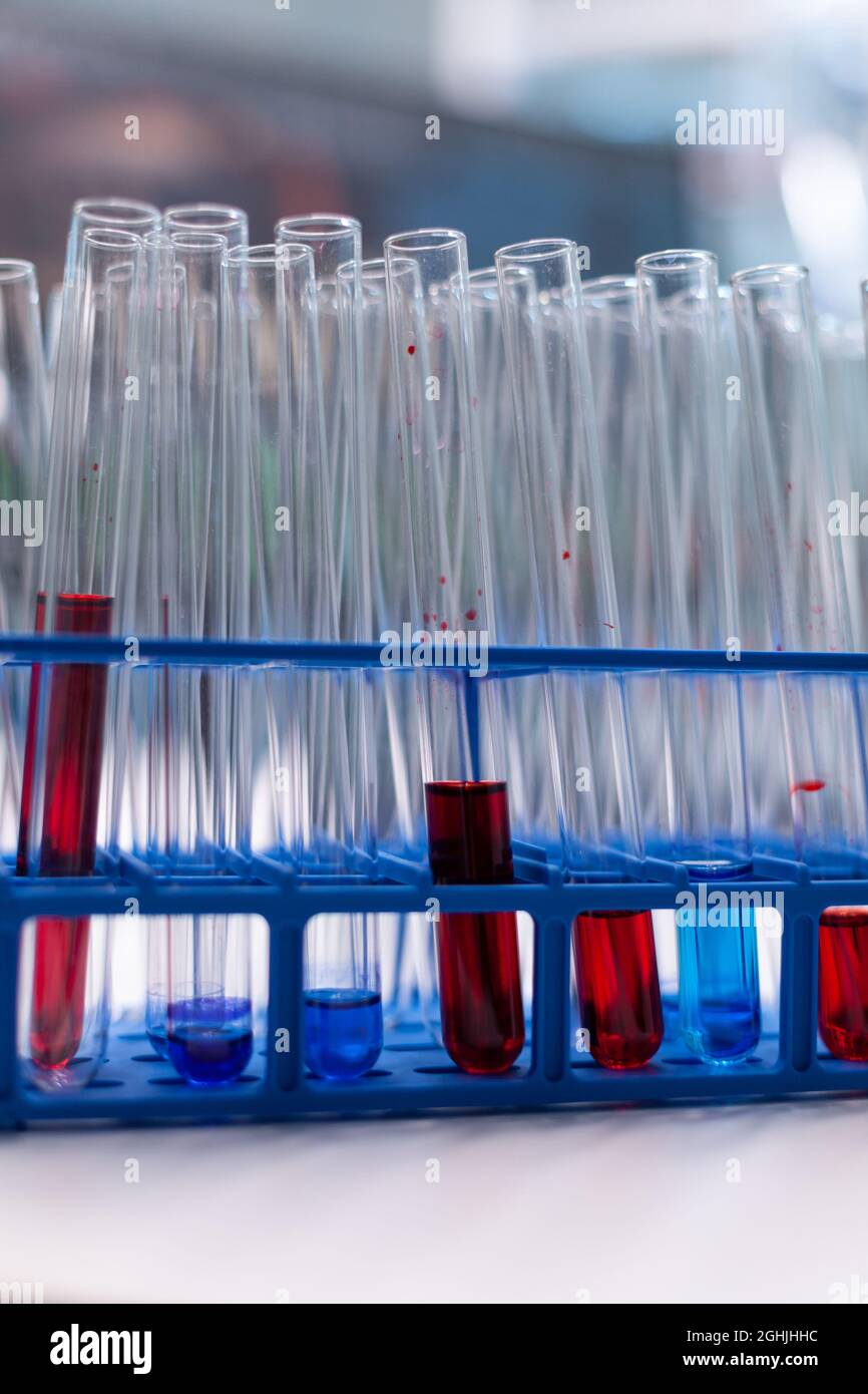 Medical test tube with blood standing on table during chemistry ...