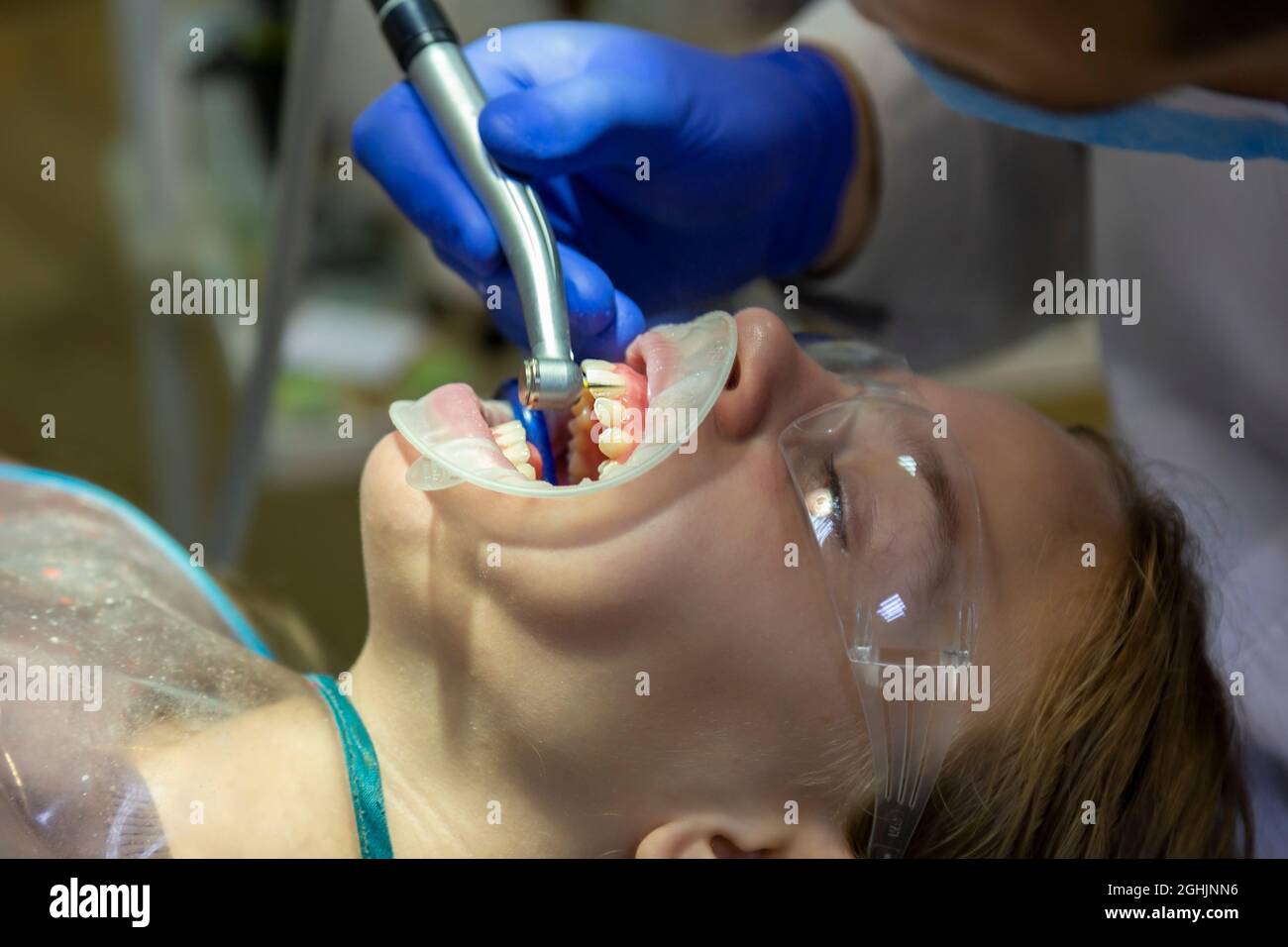 Tooth polishing, a dentist's hand drilling a child's teeth Stock Photo ...
