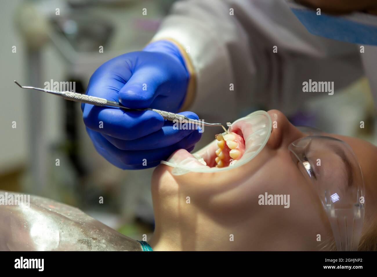 Dental tool, doctor treats children's teeth. Visiting the dentist Stock ...