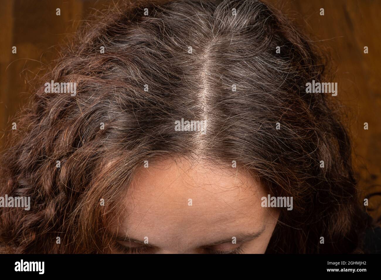 Hair follicles scalp hi-res stock photography and images - Alamy