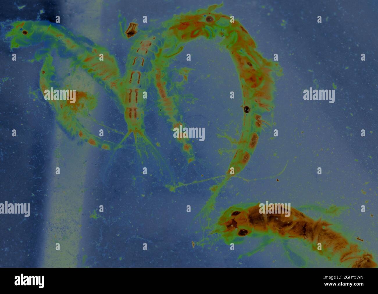 Macro of parasite organism or bugs under a microscope on a blue ...