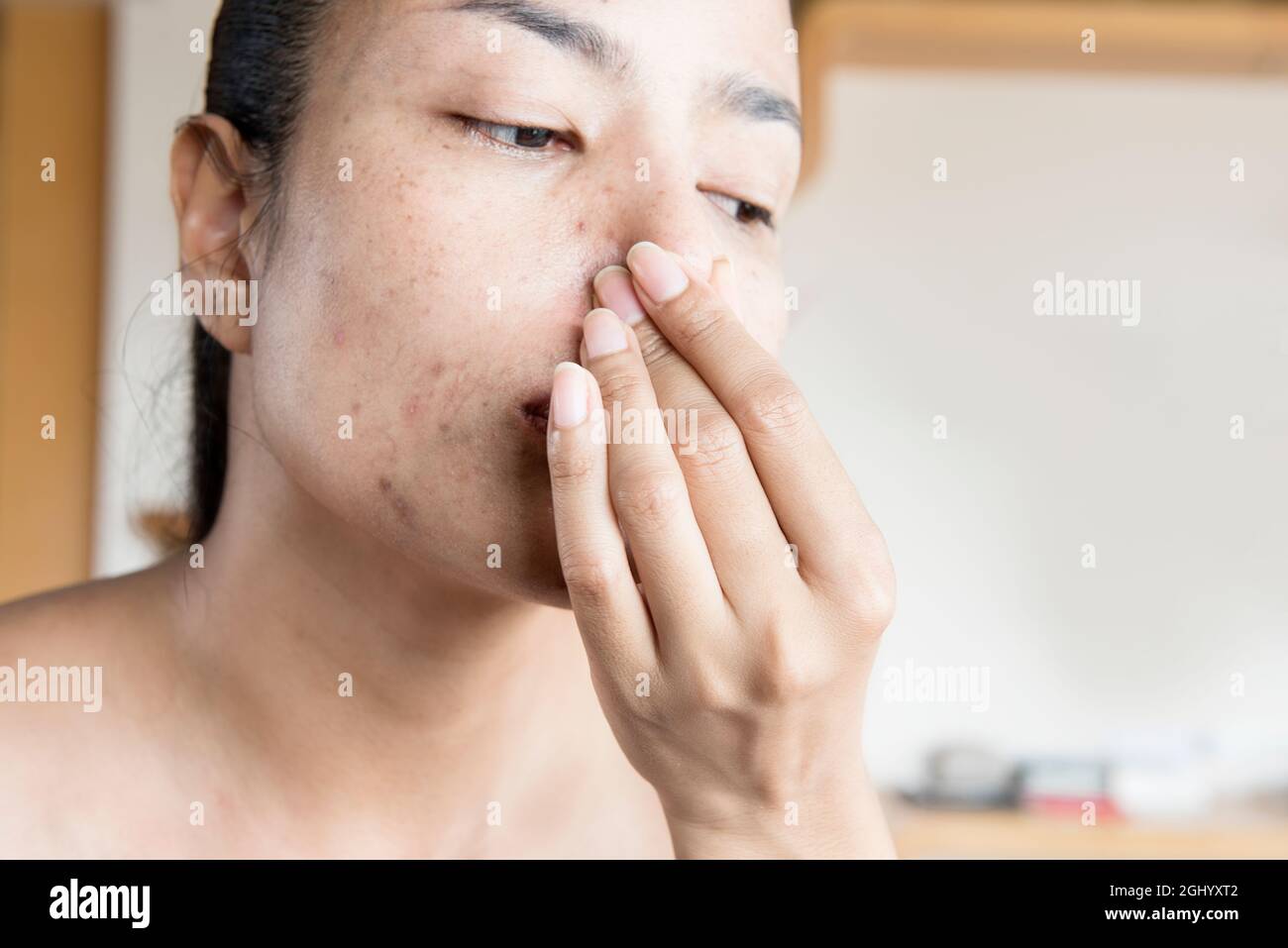 Women who have problems with dry skin and turn to flaky skin, or very ...