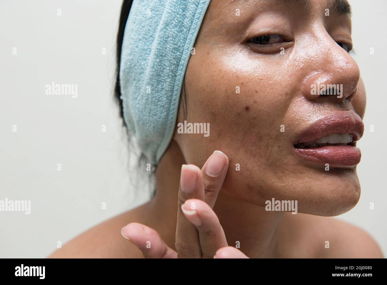 Blurry of crazy woman with very oily skin.Include the bumpy, sensitive ...