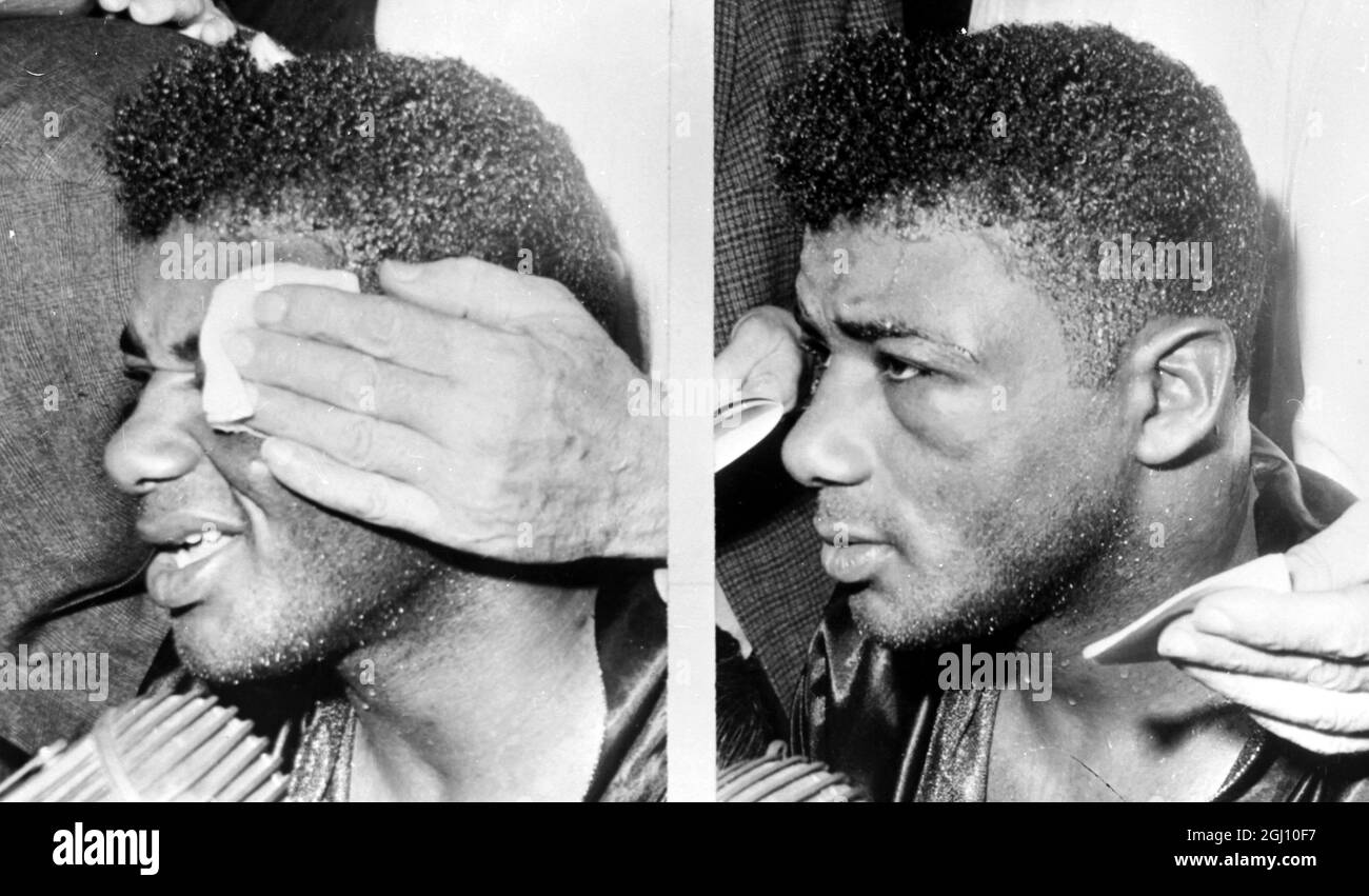 BOXING LLOYD PATTERSON CUT EYE PRESSING AFTER A BOXING WITH INGEMAR ...