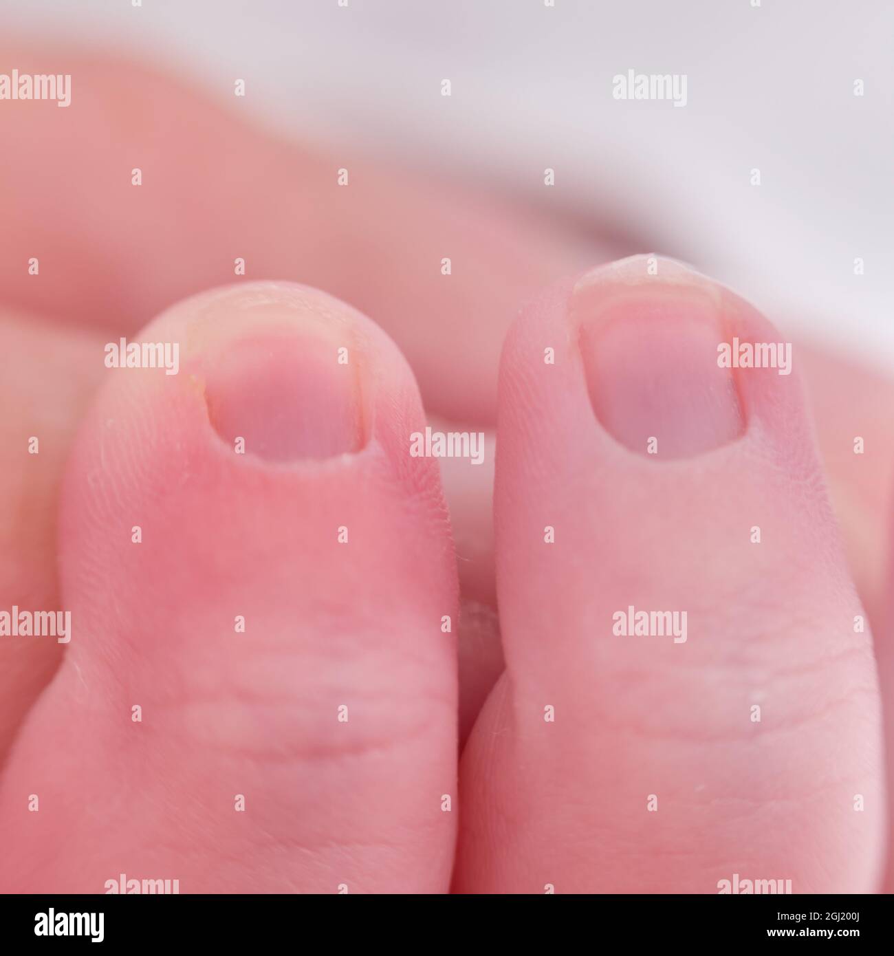 Hand child cute skin texture hi-res stock photography and images - Alamy