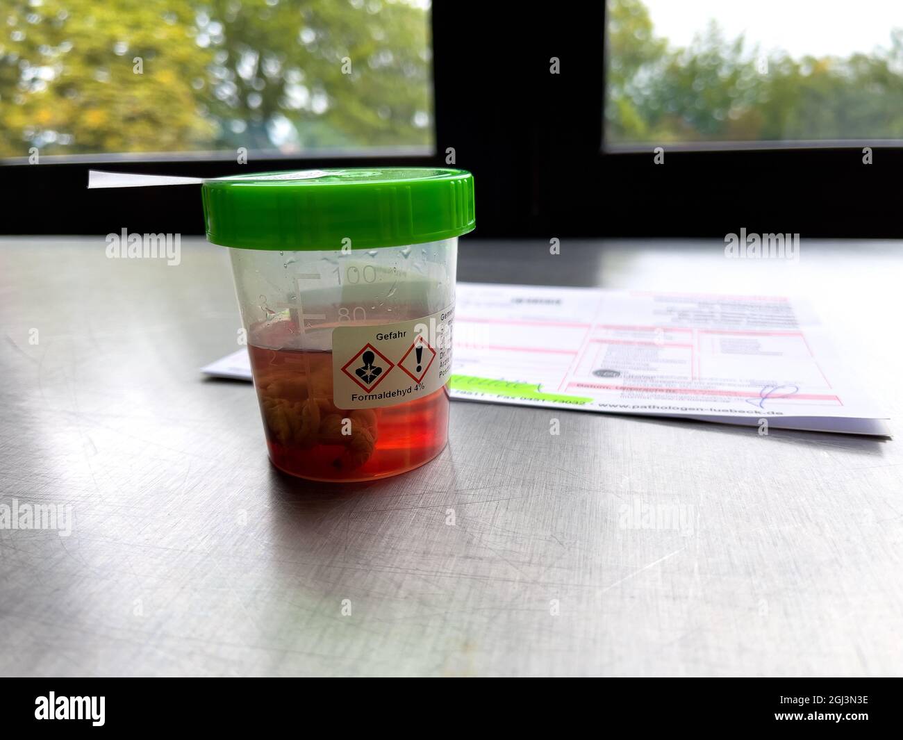 a preparation pot contains a specimen for histological examination ...