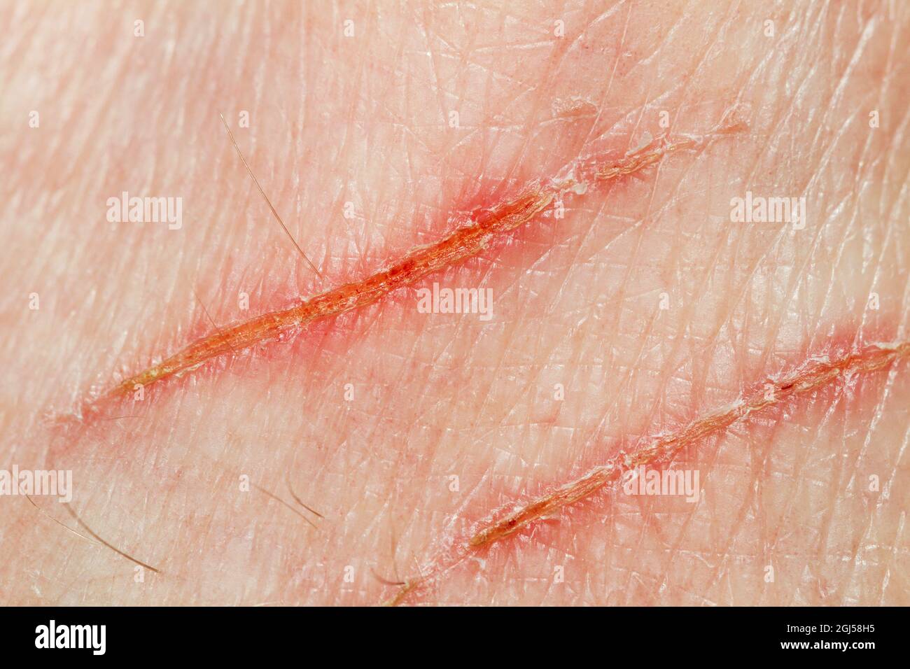 Cat's scratches on the skin. Closeup, selective focus Stock Photo - Alamy