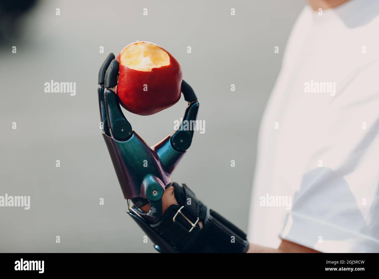Young disabled man hold apple with artificial prosthetic hand in casual ...