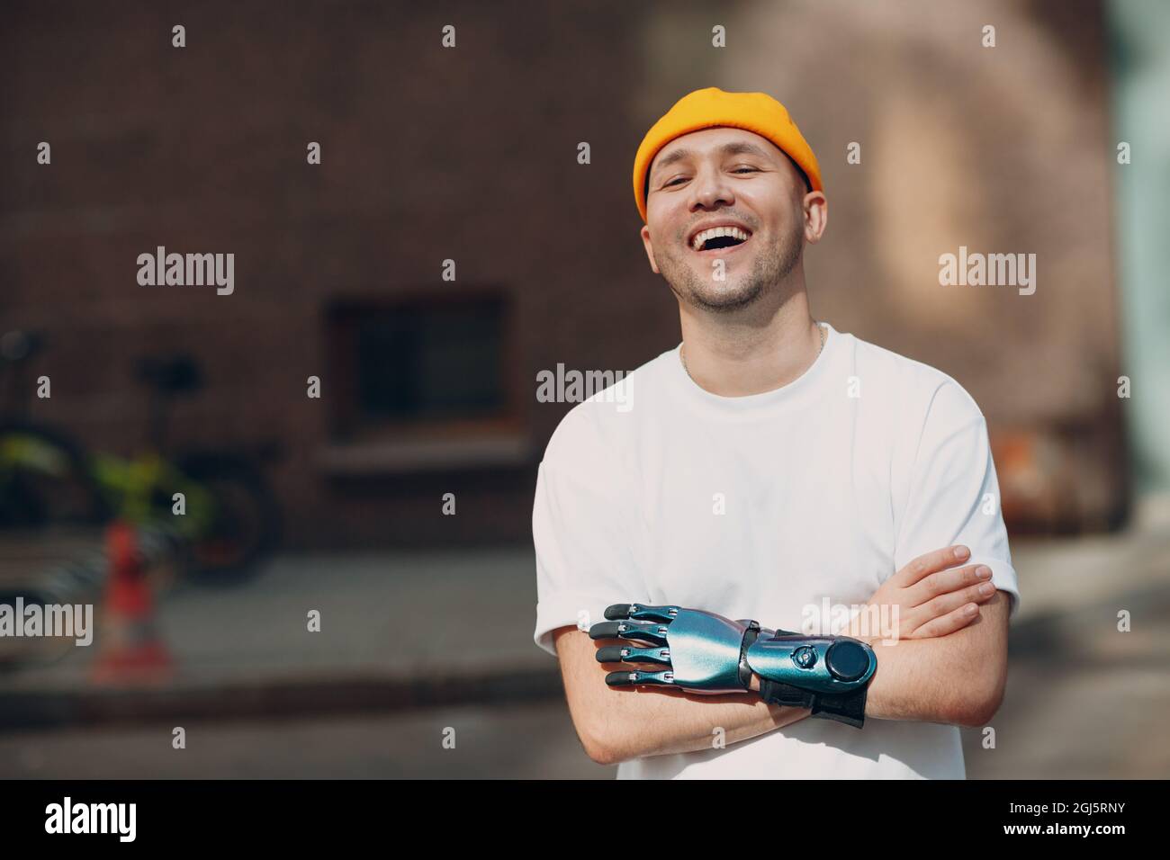 Young disabled laughing man with artificial prosthetic crossed hand ...