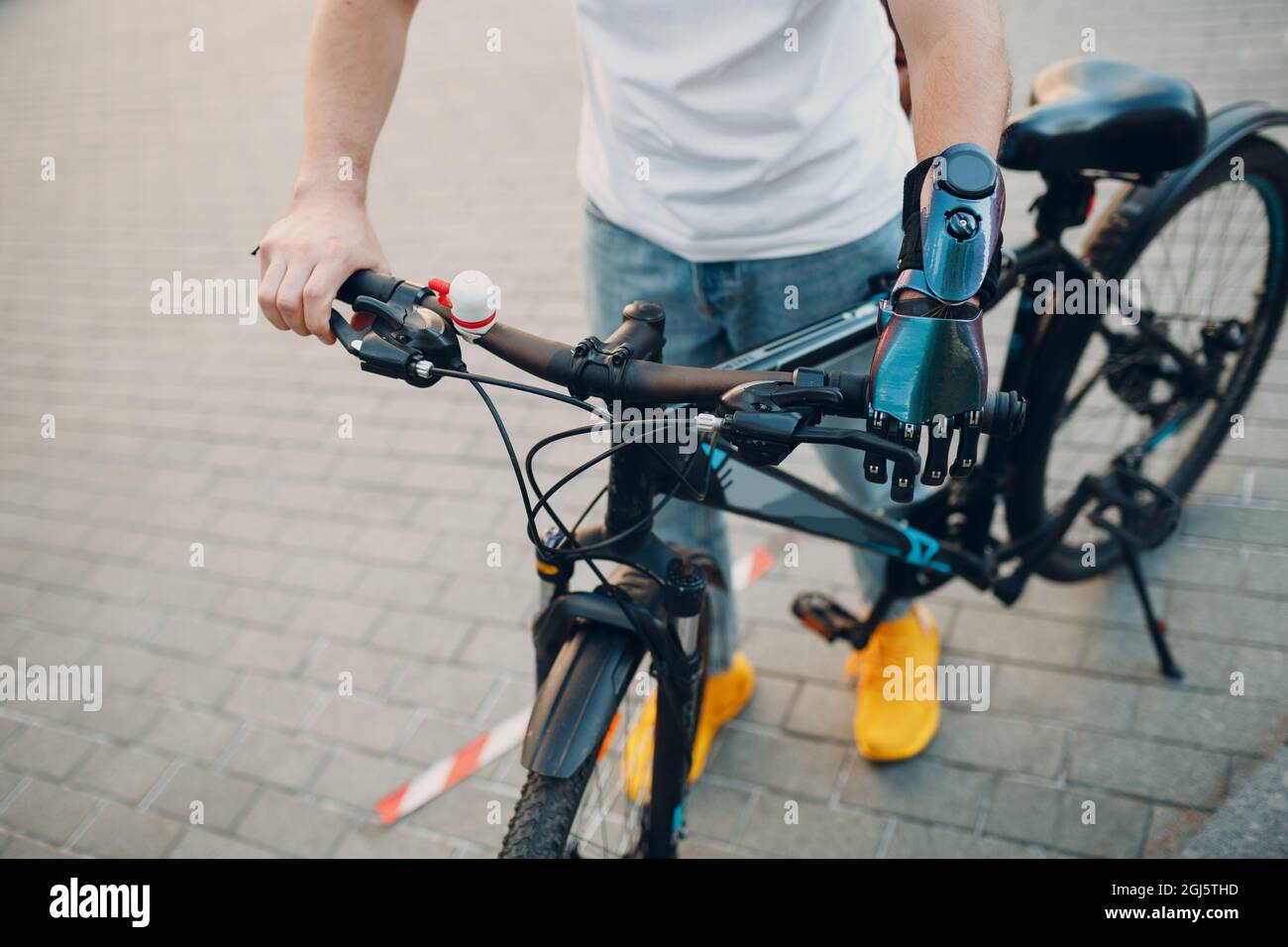 Young disabled man with artificial prosthetic hand in casual clothes ...