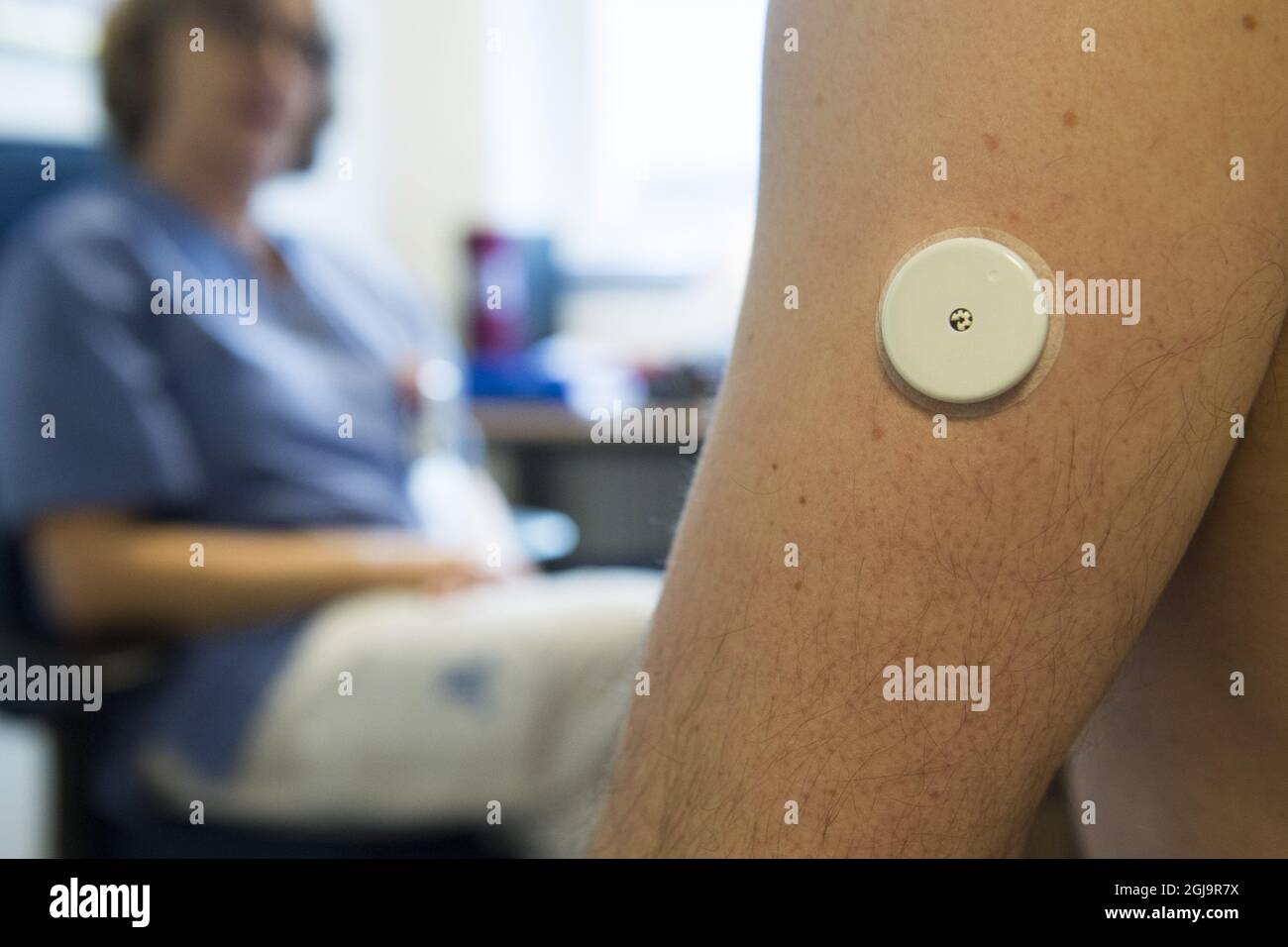 STOCKHOLM 2016-03-08 A patient with diabetes undergoes an operation to ...