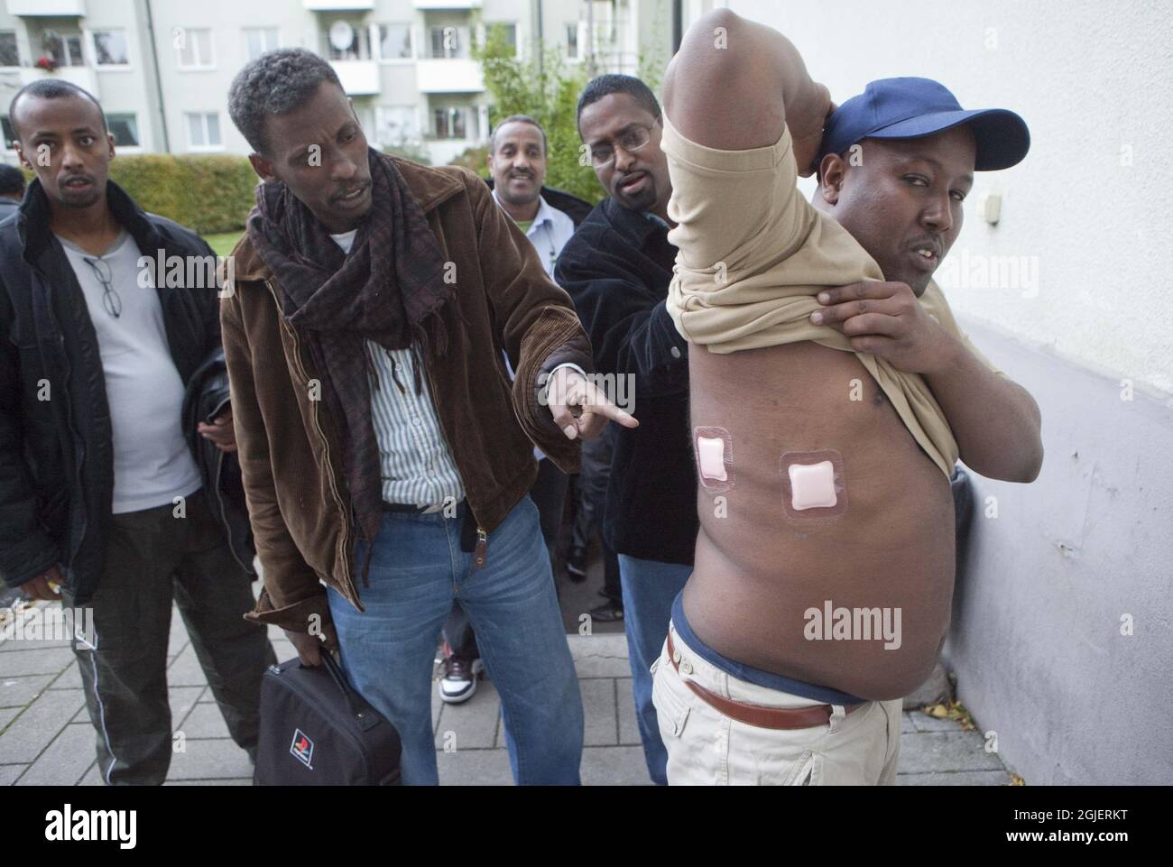 Basi Hassan shows where he was hit by an unknown gunman in Malmo ...